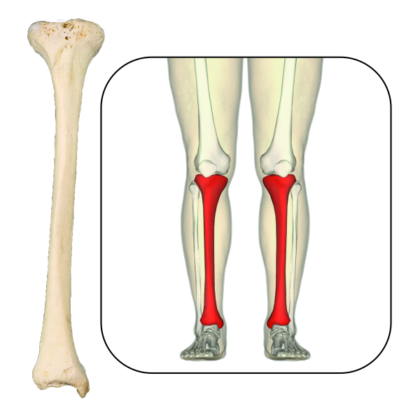 Trauma – Nebula Surgical Pvt. Ltd.